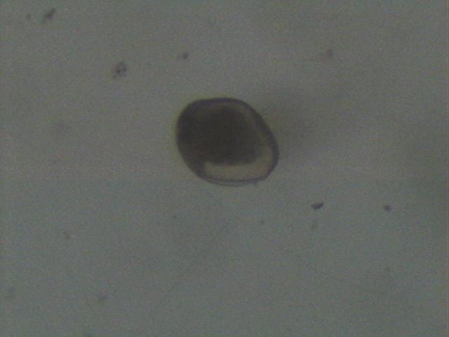 Zooplankton of the Great Lakes