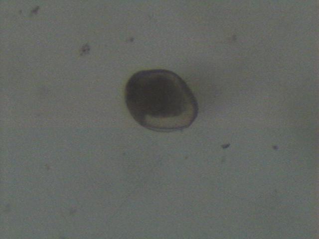 Zooplankton of the Great Lakes